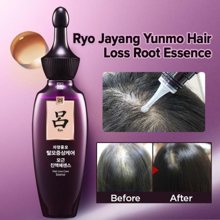 พร้อมส่ง!! Ryo Hair Loss Care Essence 75 ml. เรียว แฮร์ ลอส แคร์ เอสเซน ...