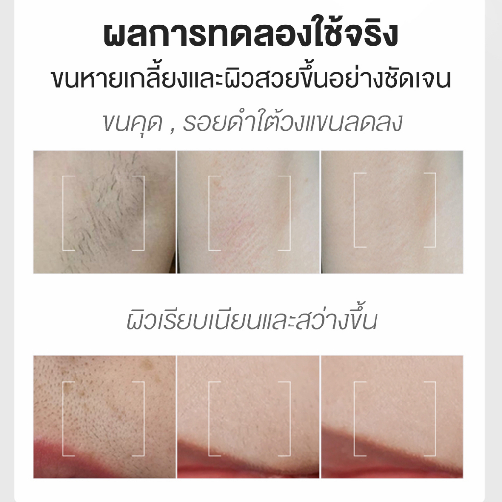 Ulike Rose IPL เครื่องกำจัดขน Sapphire ice-cooling เกรดทางการแพทย์ 4 ...