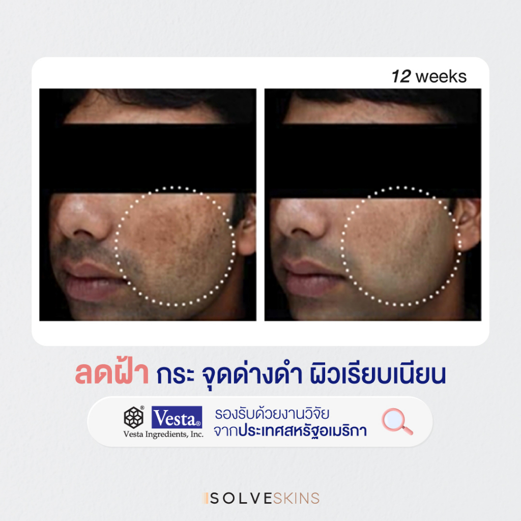 SKN Plus Pine Bark 10X Skin Booster วิตามินกู้ผิวพังกันผิวแก่ ...