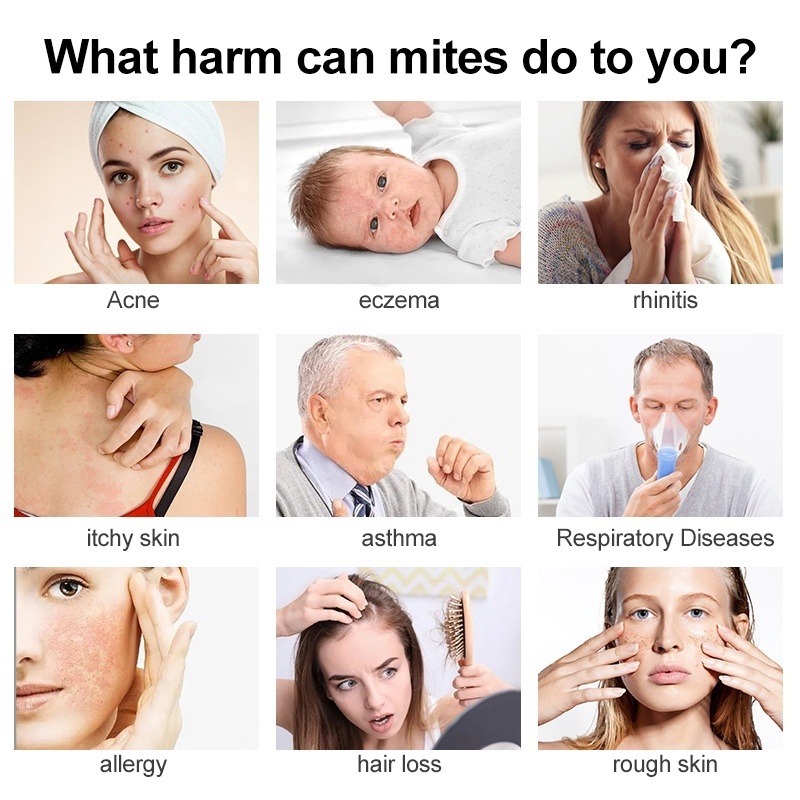 รับประกัน 5 ปี Xton Dust Mite LPMY-017 VacuumCleaner เครื่องดูดไรฝุ่น เครื่องกำจัดไรฝุ่น พร้อม ...