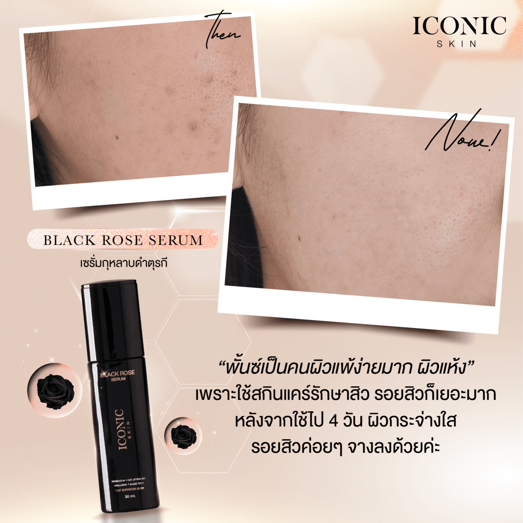 iconicskin, ร้านค้าออนไลน์ | Shopee Thailand